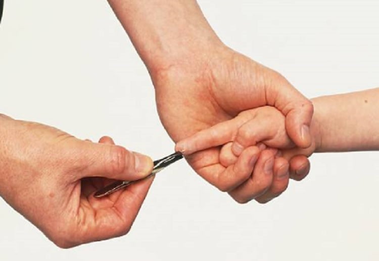 Mum's Clever Trick For Splinter Removal Goes Viral - Mouths of Mums